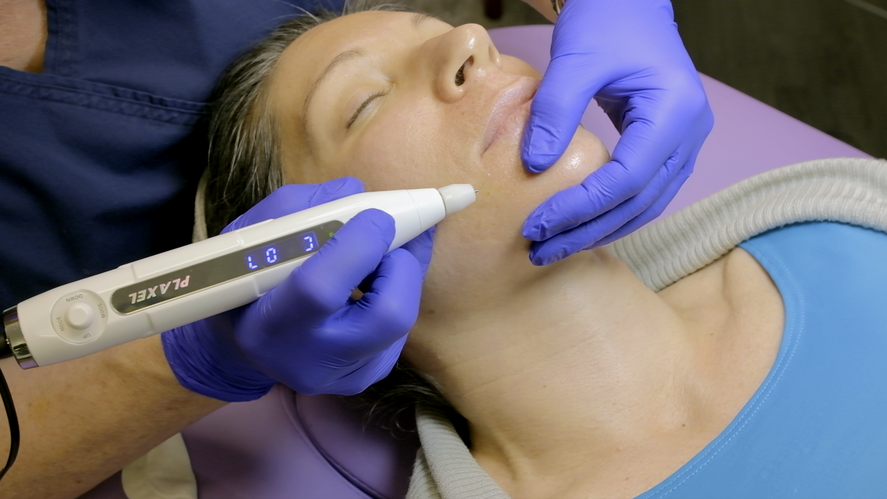 In-Person Plasma Pen Training – PLAXEL Shop